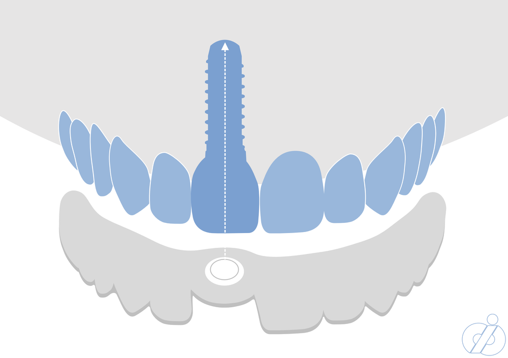 Centrum Implantologie Castricum