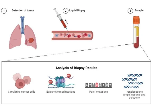 Understanding MRD in Solid Tumors — BLOODPAC