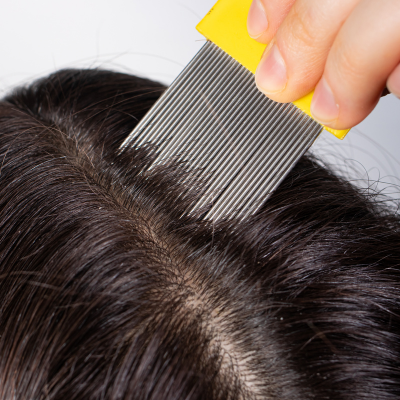 Manual Nit Removal Services-Baton Rouge, Lafayette -Nitwits LA ...