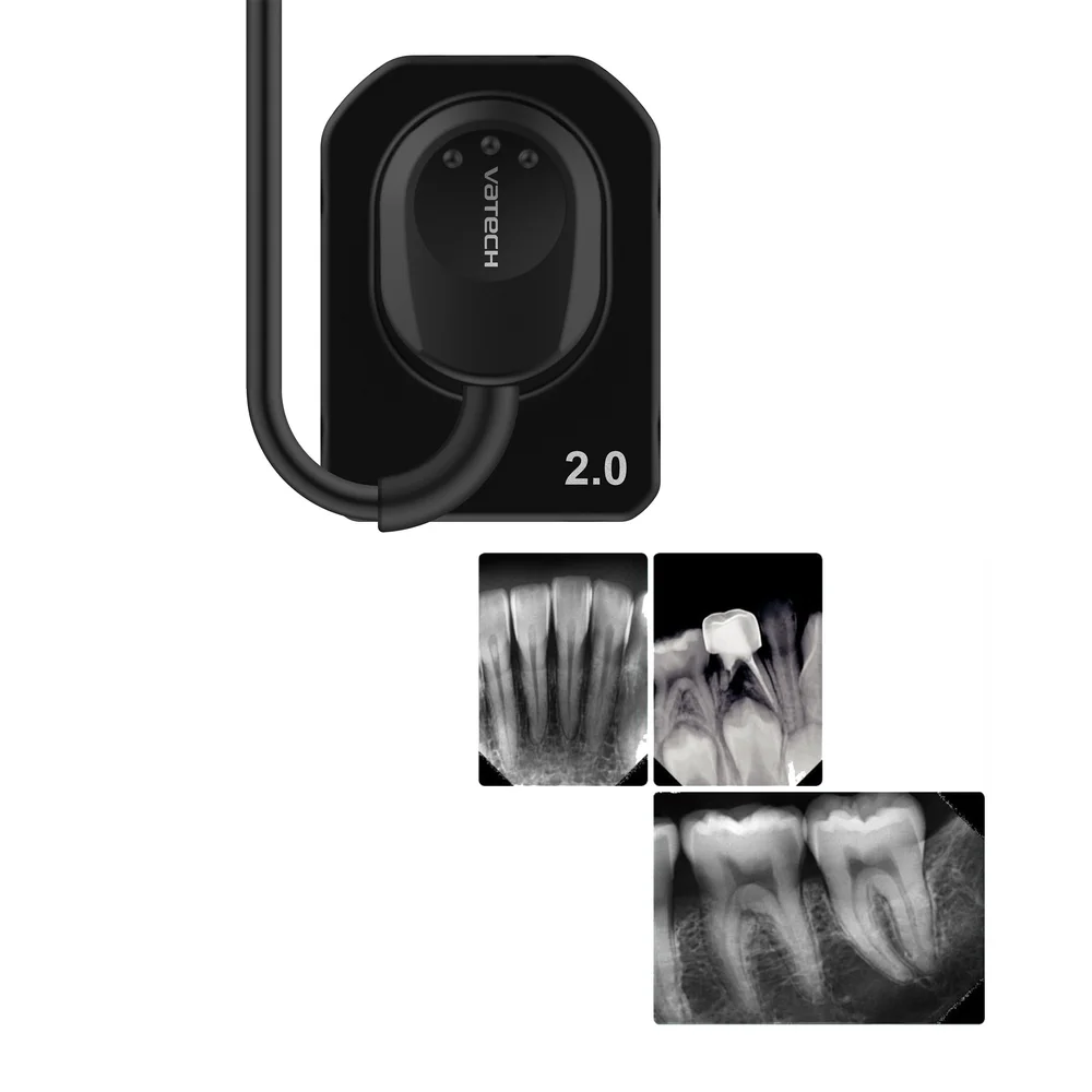 EZ Sensor Vatech | Sensor Digital Intraoral Berkualitas — PT Mandala ...