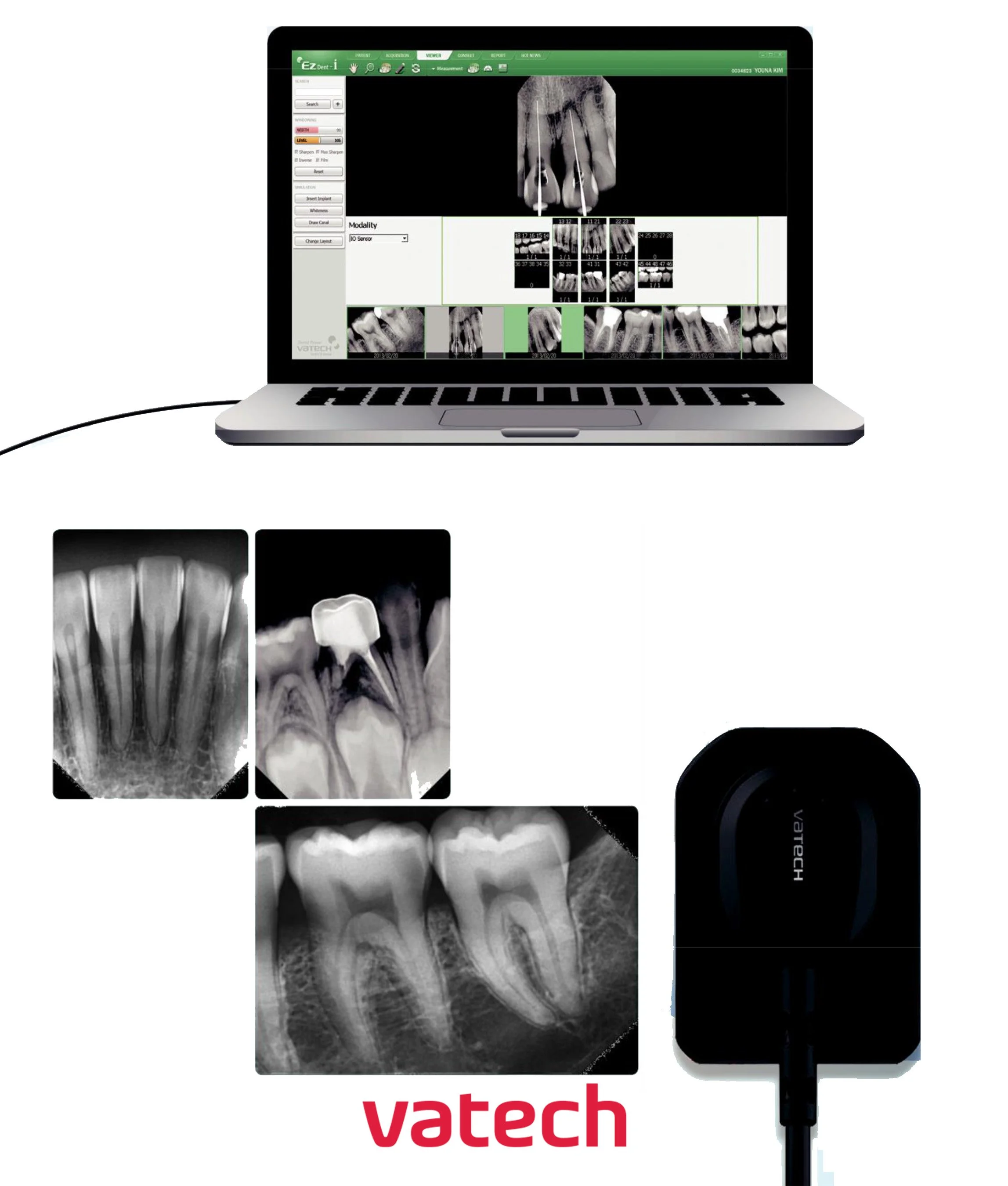 Vatech CBCT A9 | Cone Beam CT Digital untuk Klinik Gigi — PT Mandala Mitratama