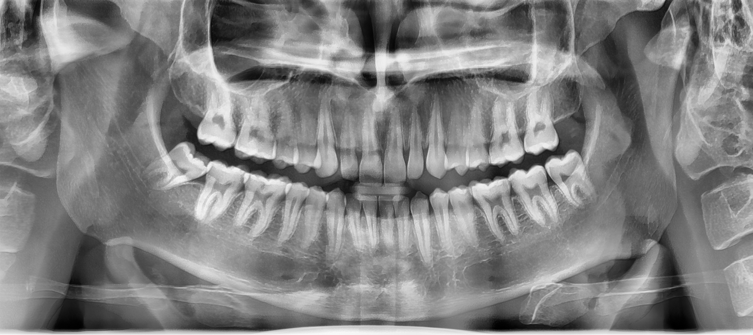 X-Ray Dental | Gambar Lengkap & Akurat — PT Mandala Mitratama