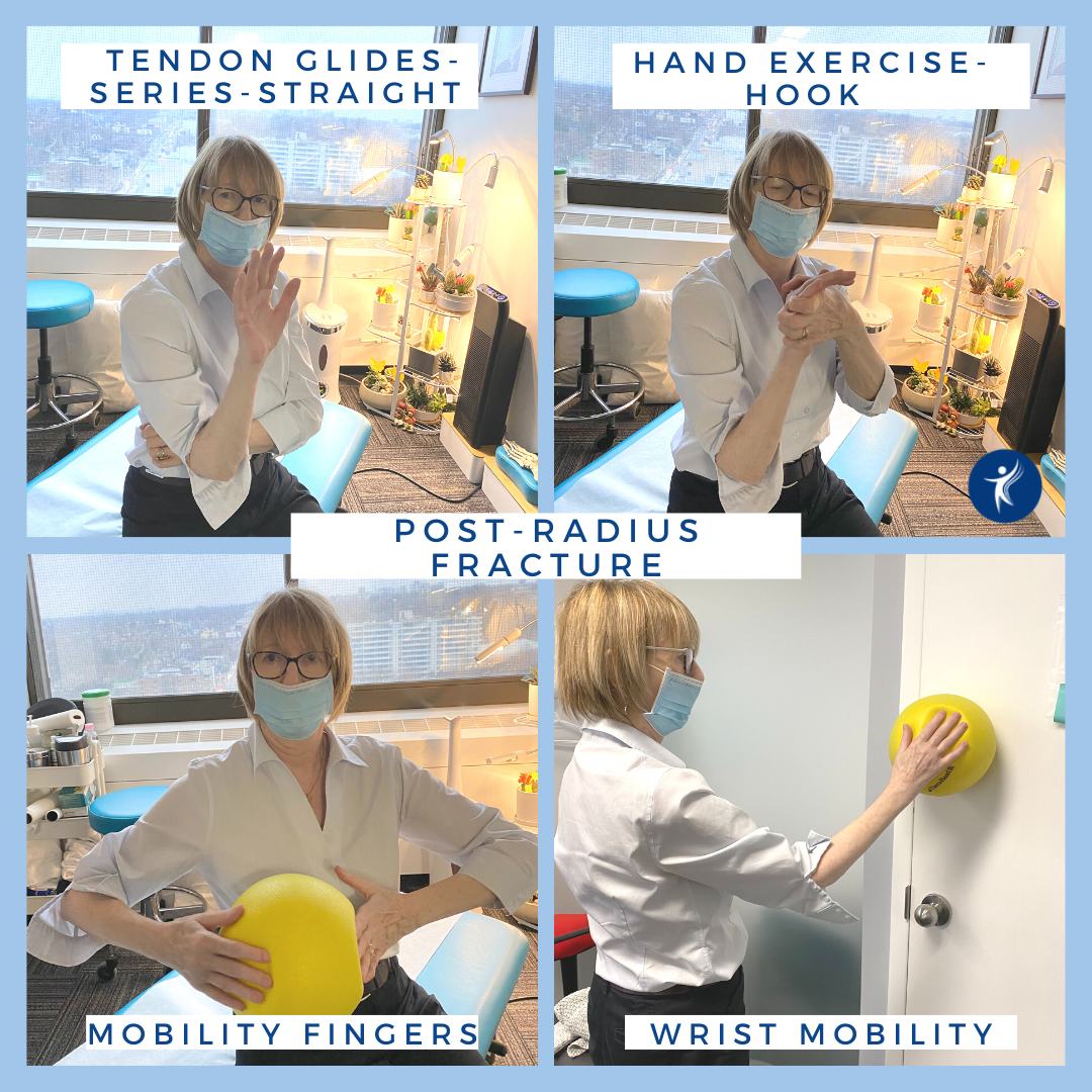 Distal Radius Fracture — Eglinton Physiotherapy