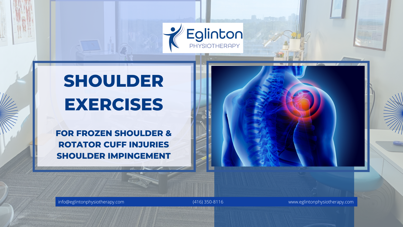 Shoulder Exercises — Eglinton Physiotherapy