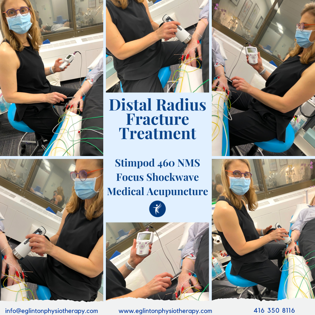Distal Radius Fracture — Eglinton Physiotherapy