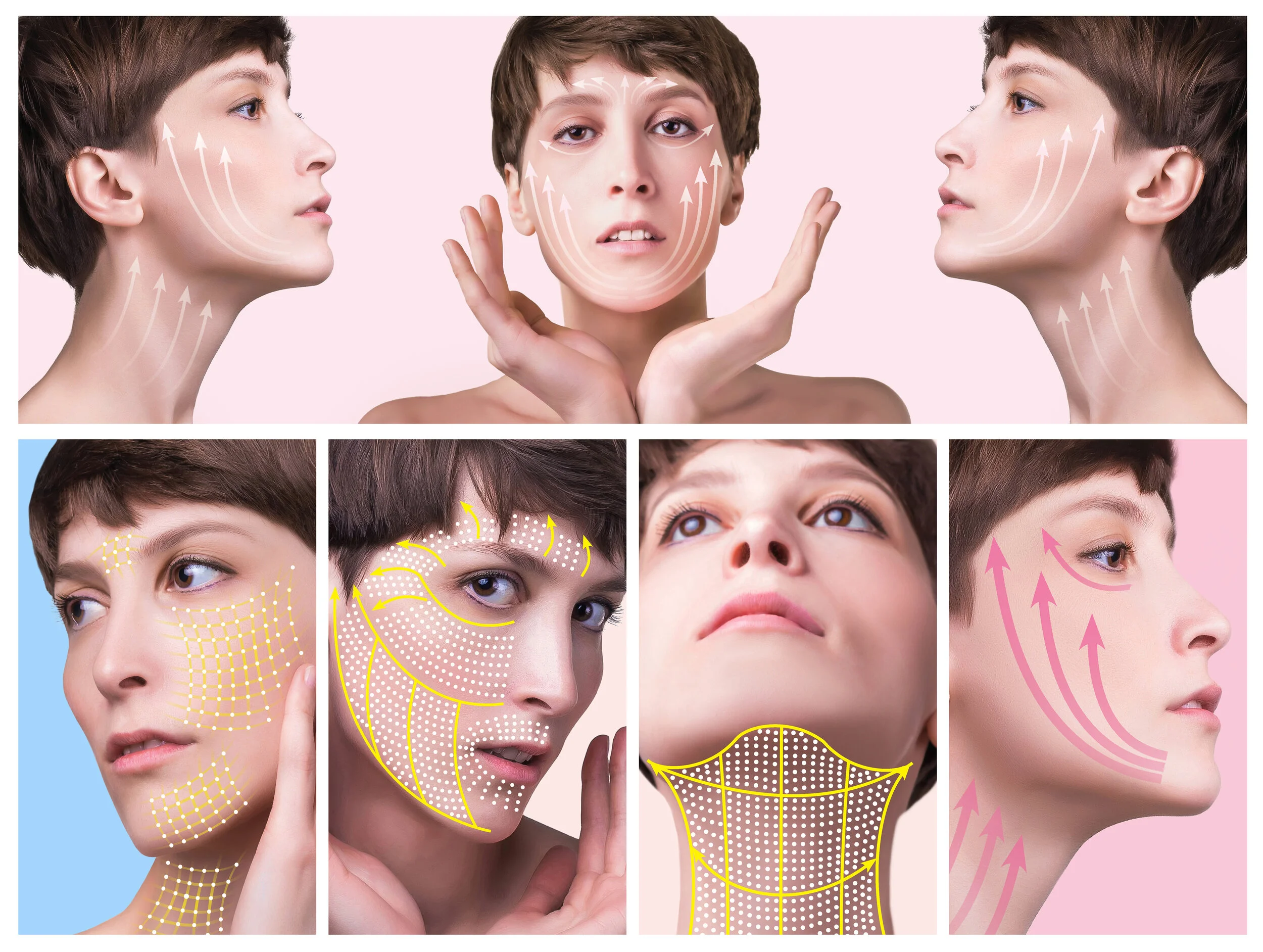Thread Lifting - Chicago H Med Spa — H Med Spa in Wicker Park