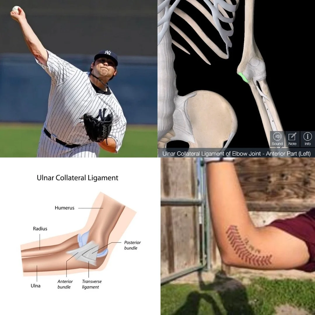 Ulnar Collateral Ligament Elbow Reconstruction