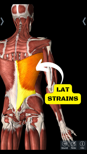 How to Handle Lat Strains in Pitchers – Armored Heat App