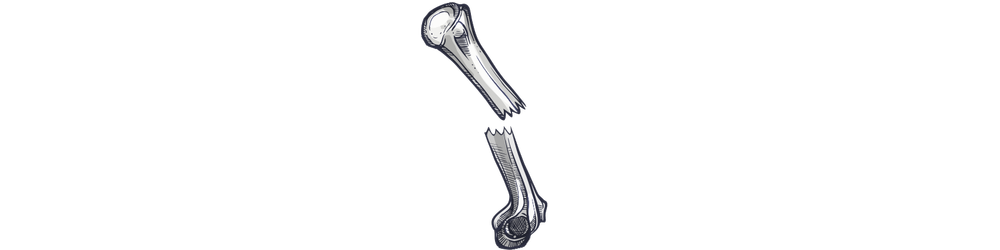 Orthopaedic Knee Surgeon Melbourne | Mr Lachlan Batty