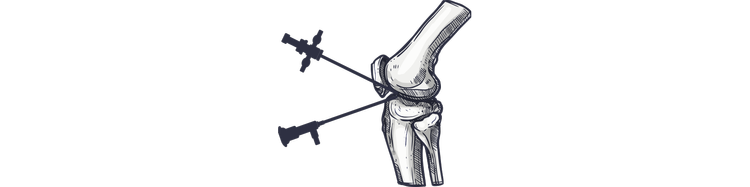 Orthopaedic Knee Surgeon Melbourne | Mr Lachlan Batty