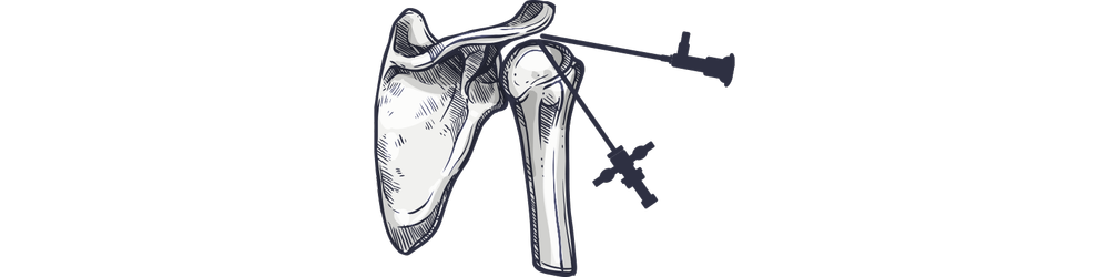 Orthopaedic Knee Surgeon Melbourne | Mr Lachlan Batty