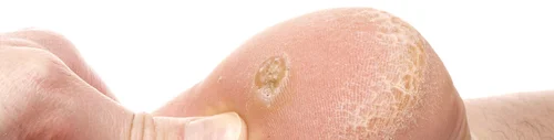 Bupa Podiatry Services
