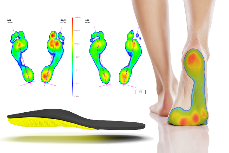 Choosing the Right Orthotics for Your Feet: A Comprehensive Guide — The ...