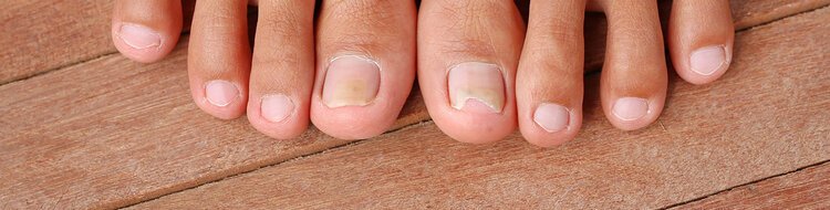 Bupa Podiatry Services