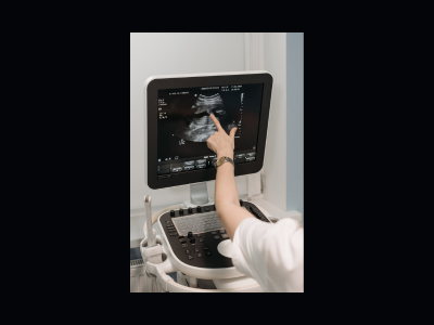 Muscle Tear: felt snap during playing football or sports. Ultrasound ...