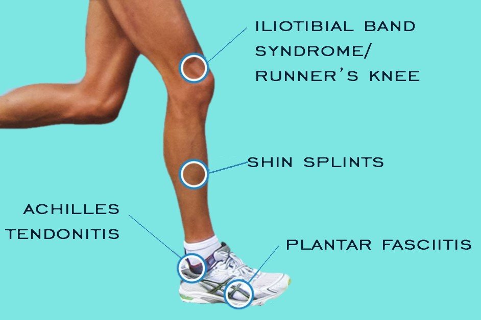 How to prevent running or marathon injuries? — The Podiatry Clinics