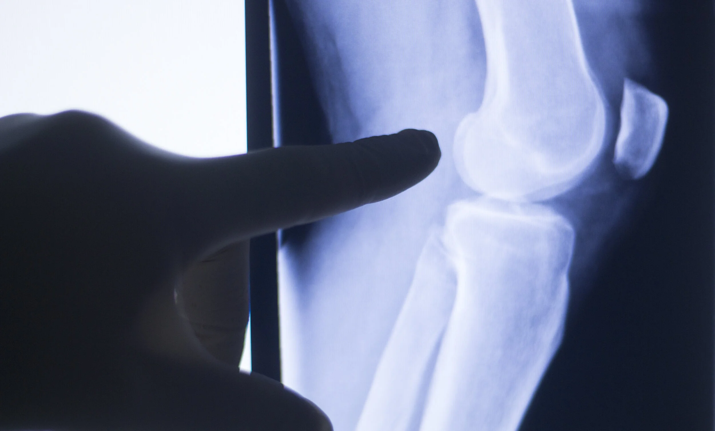 radiology astley medical centre st marys — Astley Medical Centre, St Marys