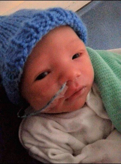 Charlie's Story: X-Linked Ichthyosis, a journey to diagnosis — Emollin