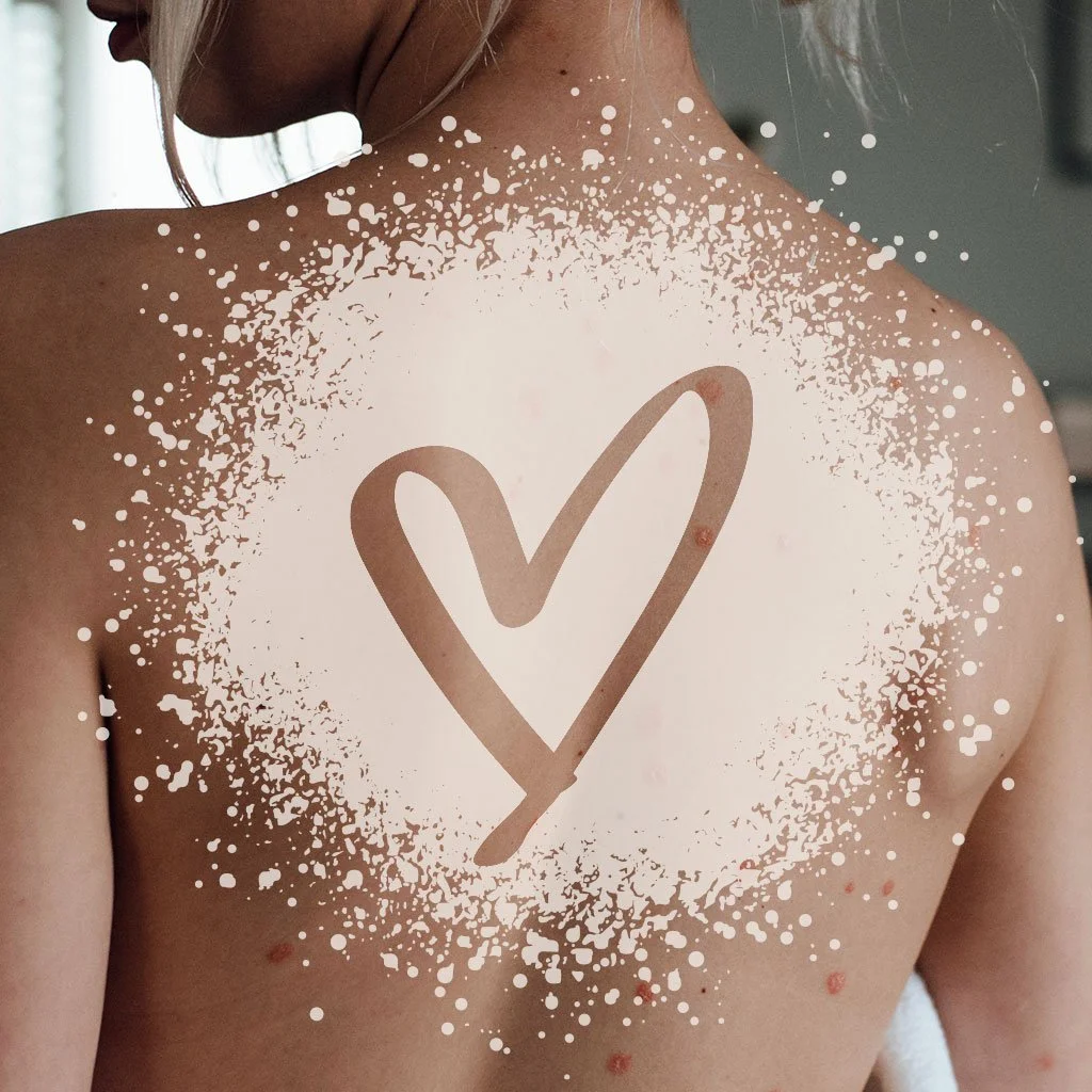 Psoriasis Relief - Spray-on Emollient for Psoriasis | Emollin® — Emollin