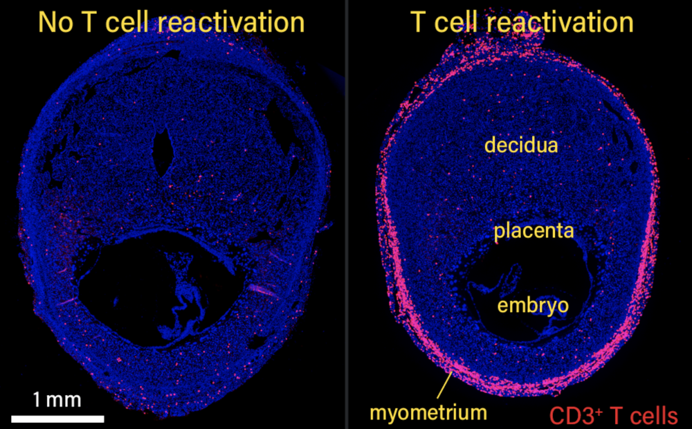 Mechanisms of fetomaternal tolerance — Erlebacher Lab