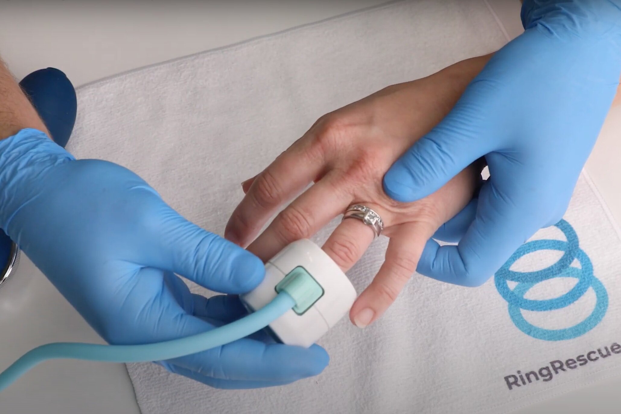 Resources For Stuck Ring Removal — Ring Rescue - Stuck Ring Removal ...