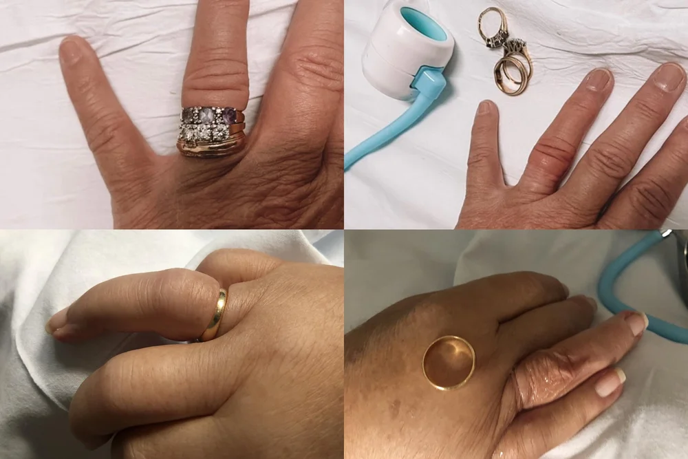 The BEST Stuck Ring Removal Solution | Ring Rescue