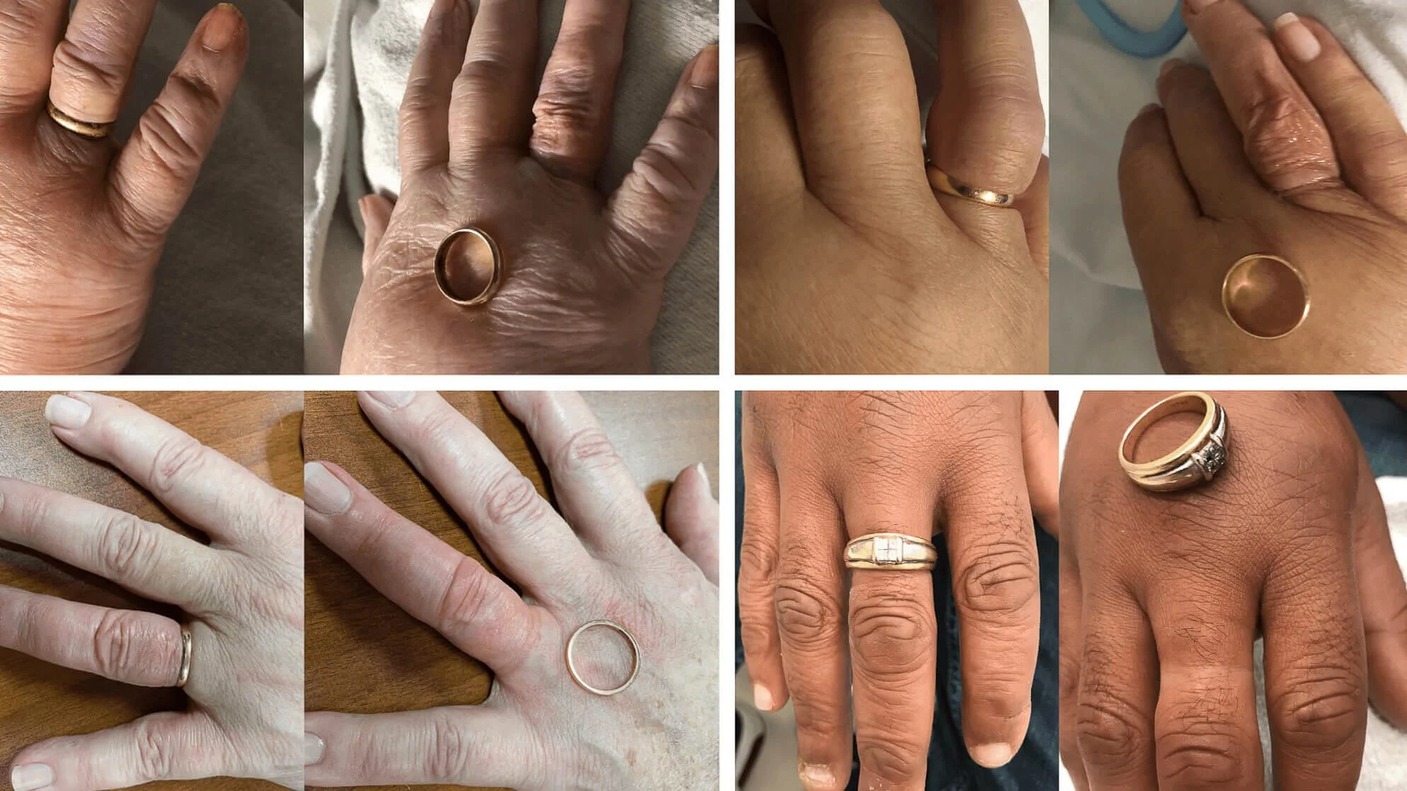 Ring Rescue Kit | Stuck Ring Removal Solution