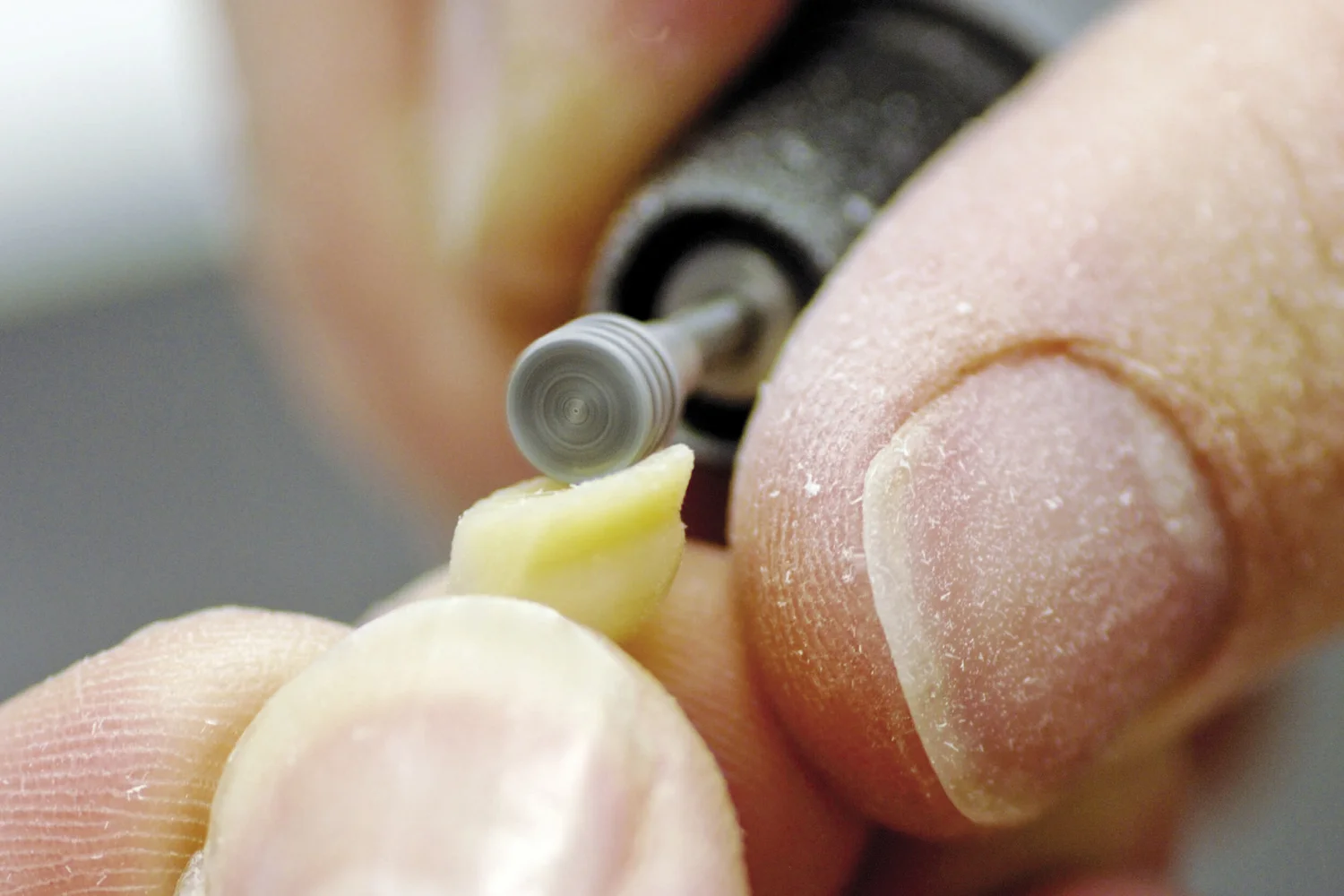 Vertex Dental - Premium Denture Solutions