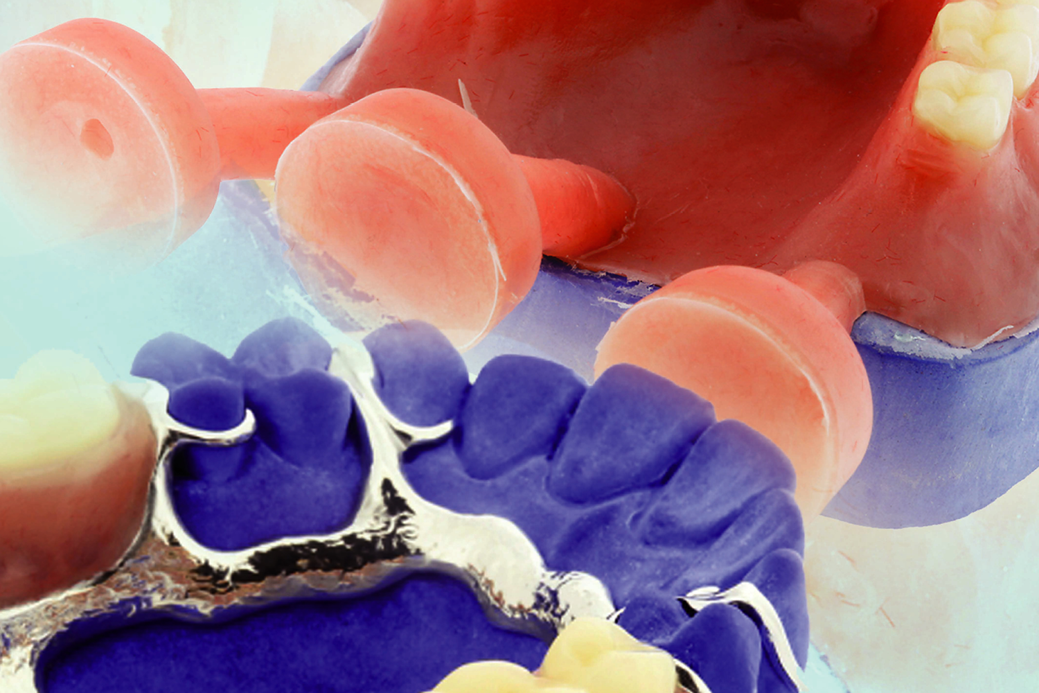 Vertex Dental - Premium Denture Solutions