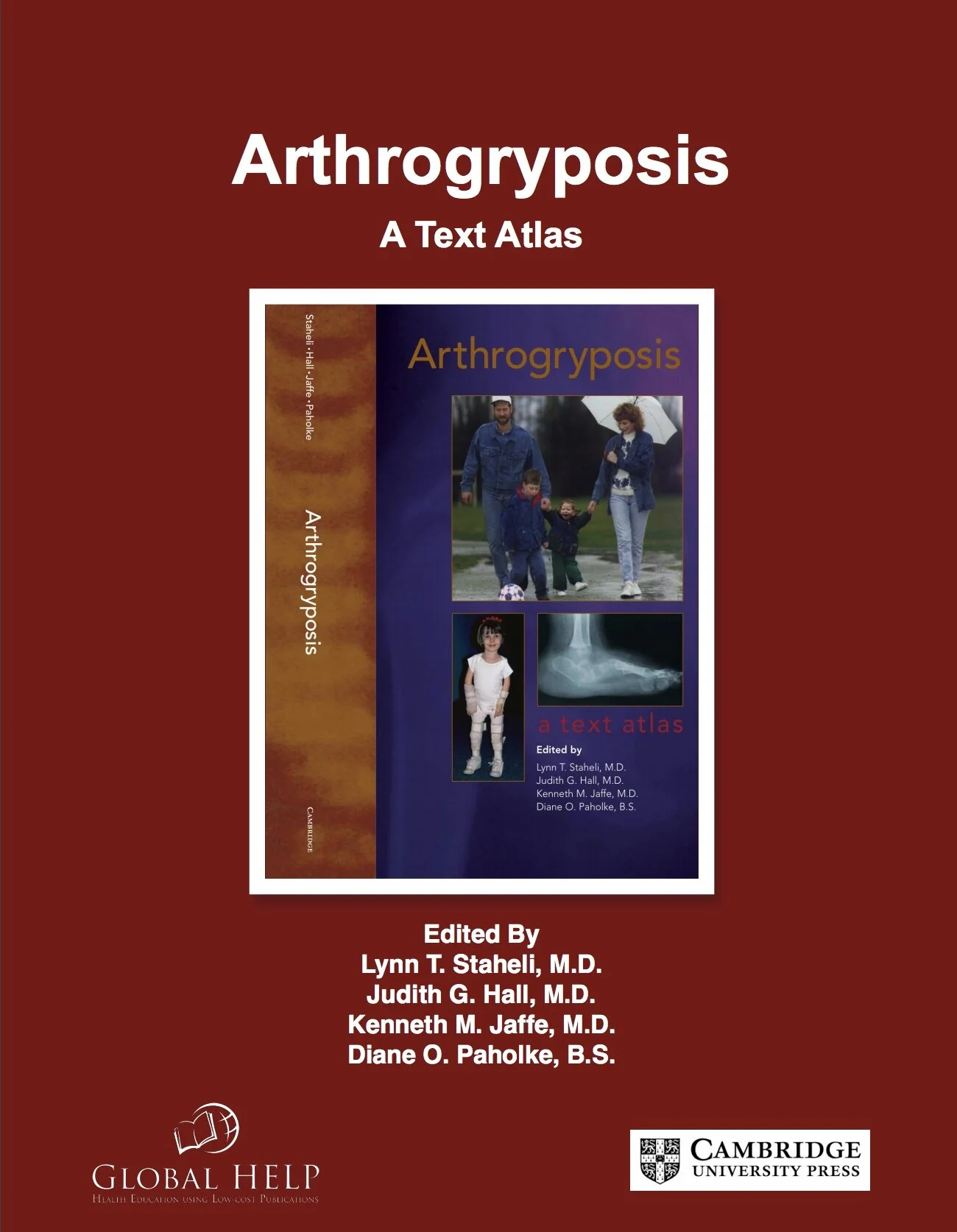 Arthrogryposis: A Text Atlas — AMC Support - Arthrogryposis