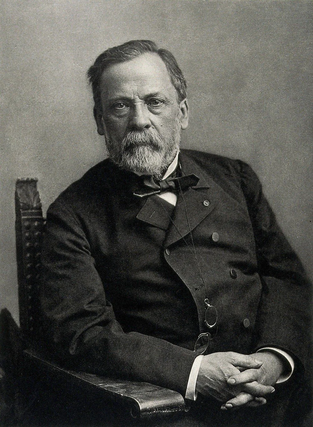 Louis Pasteur and the History of Rabies Vaccination Development ...