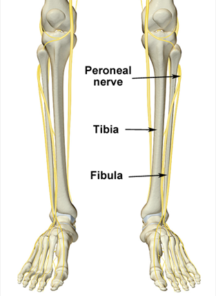Do you have foot drop? — The Nerve Injury Clinic