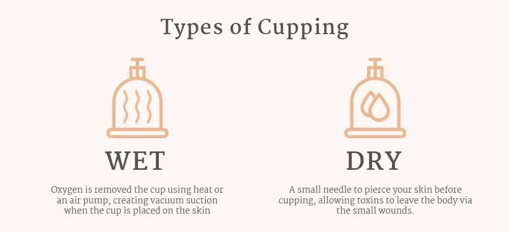 What Is Cupping & Can Cupping Therapy Help | West End Wellness — West ...