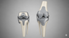 Partial vs Total Knee Replacement - Dr David Sime