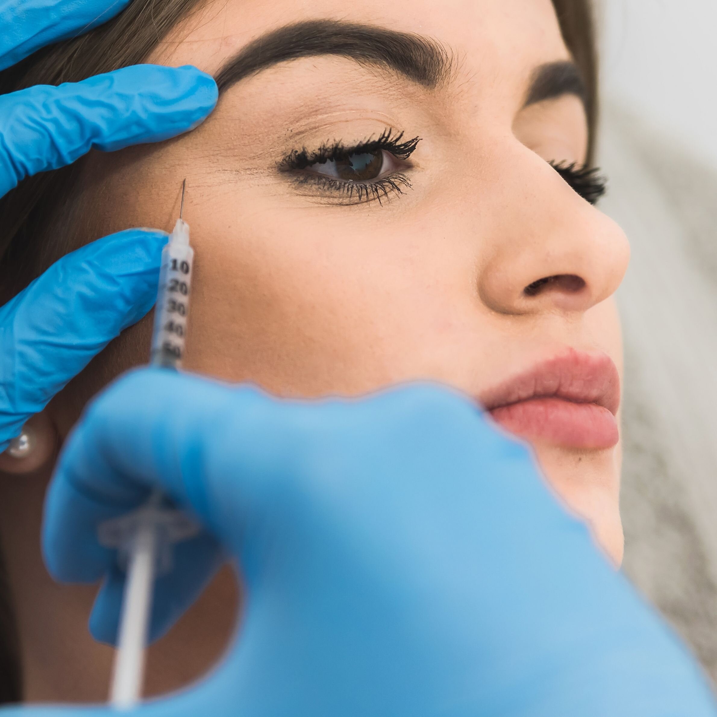 Dermal Fillers — youthtopiaskin