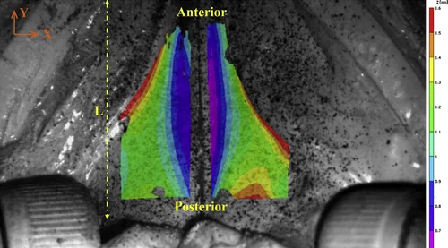 Measuring Strain in Porcine Vocal Folds with DIC — Correlated Solutions ...