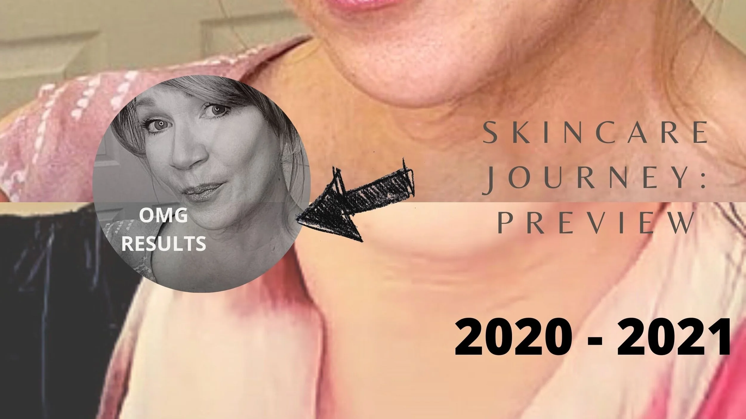 SKINCARE JOURNEY 2020-2021 - What truly regenerated my skin (sun damage ...