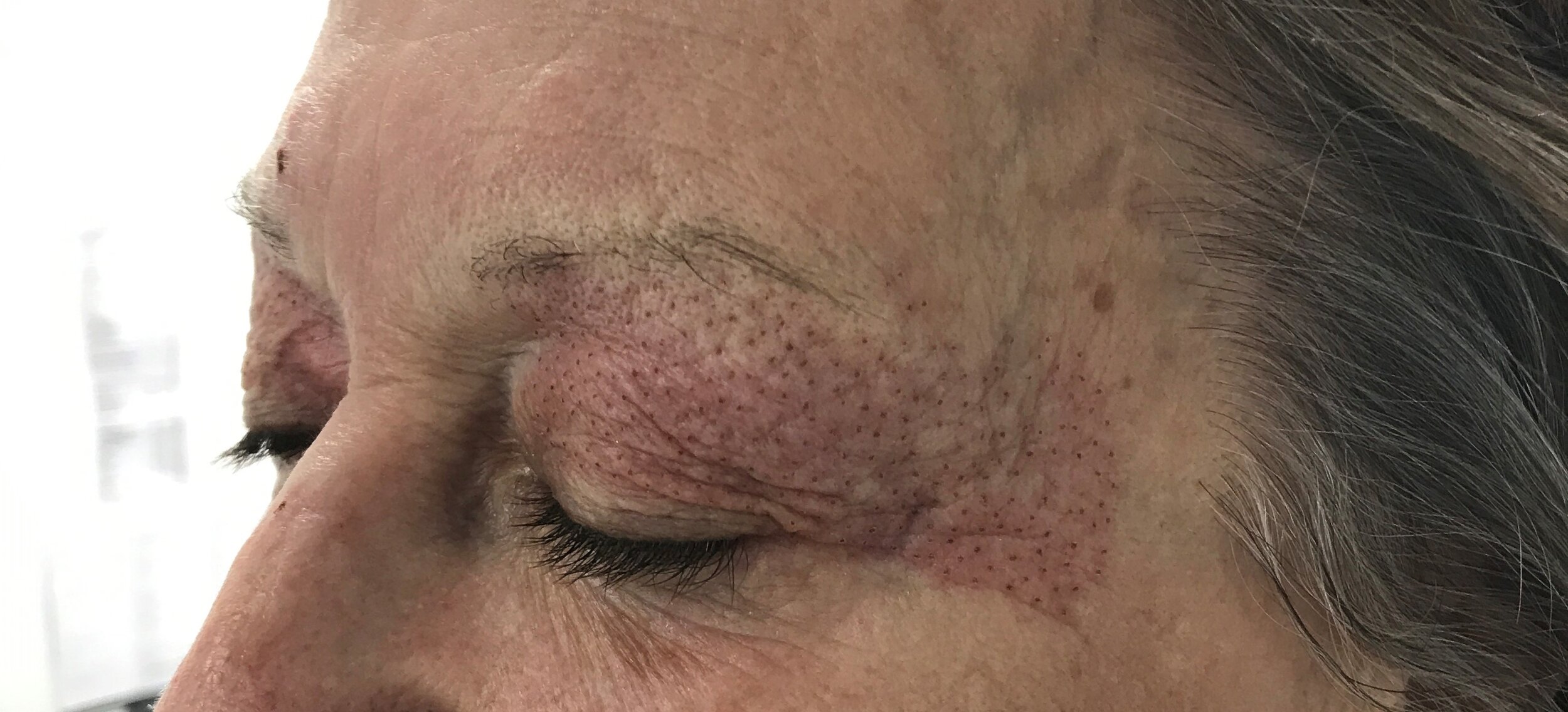 Before/After treatments — The Aesthetic Treatment Rooms