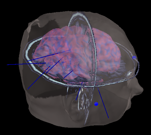 Baillet Lab [ neuroSPEED ]