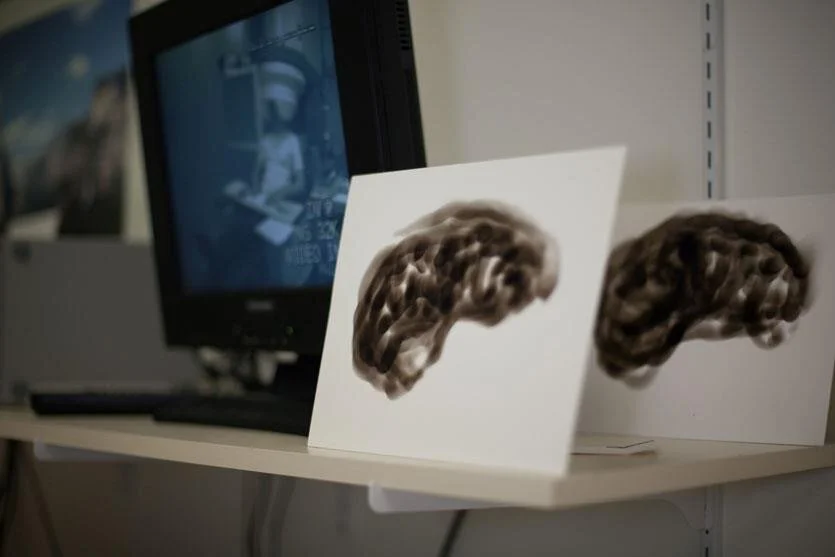 Baillet Lab [ neuroSPEED ]