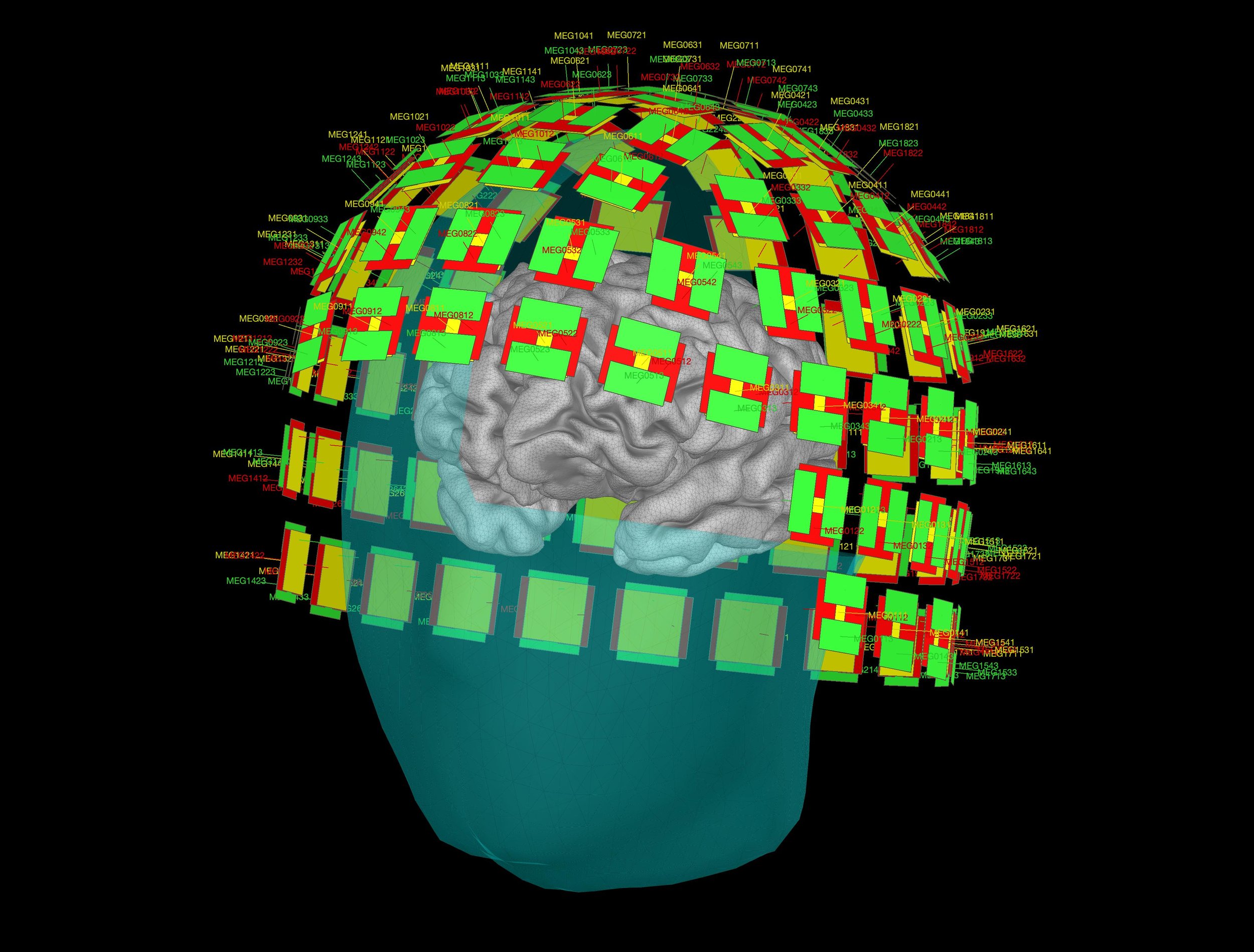 NIH supports new Brainstorm software developments to boost research on ...