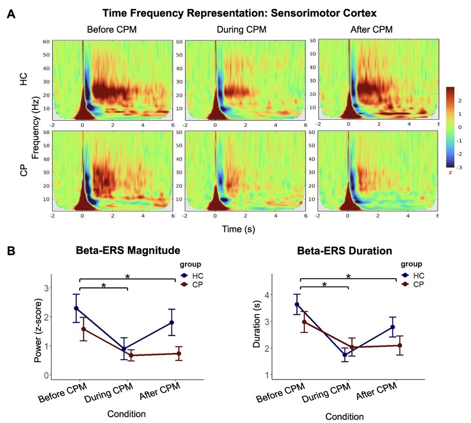 Brain and pain: a two-way street. — Baillet Lab [ neuroSPEED ]