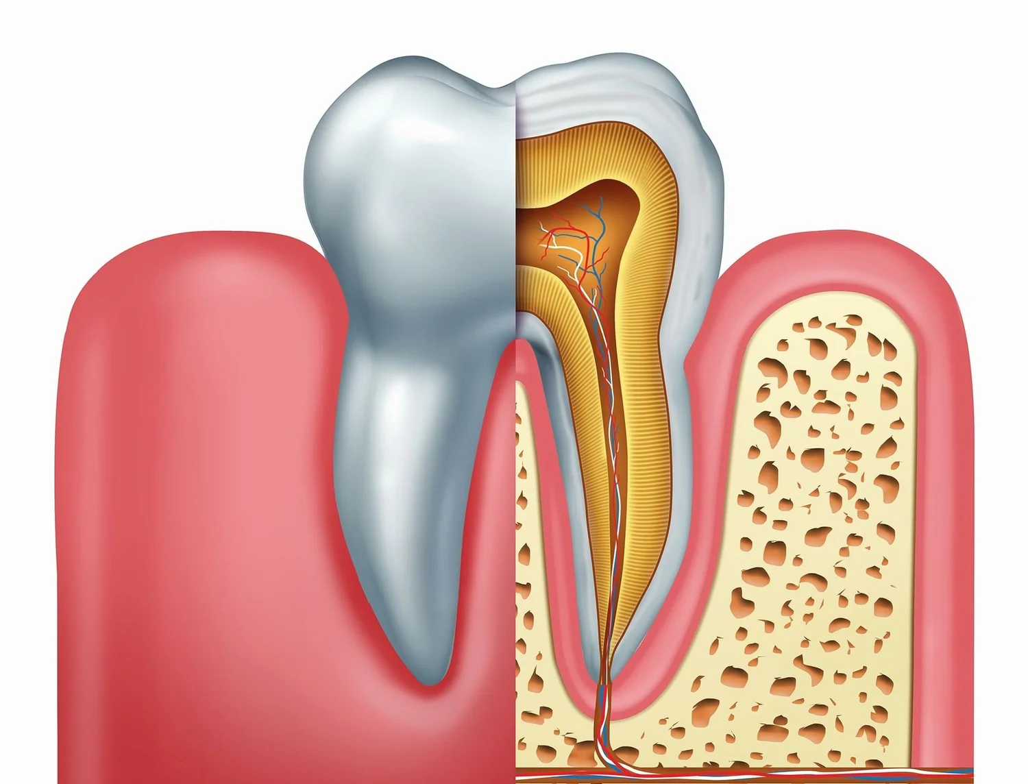 Why teeth with root canal fillings need crowns (or preferably onlays ...