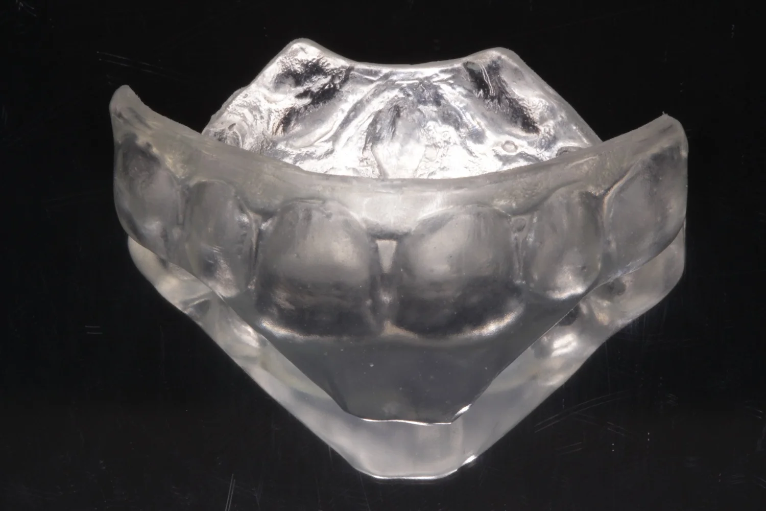 B Splints - Everything you need to know — Nova Smiles