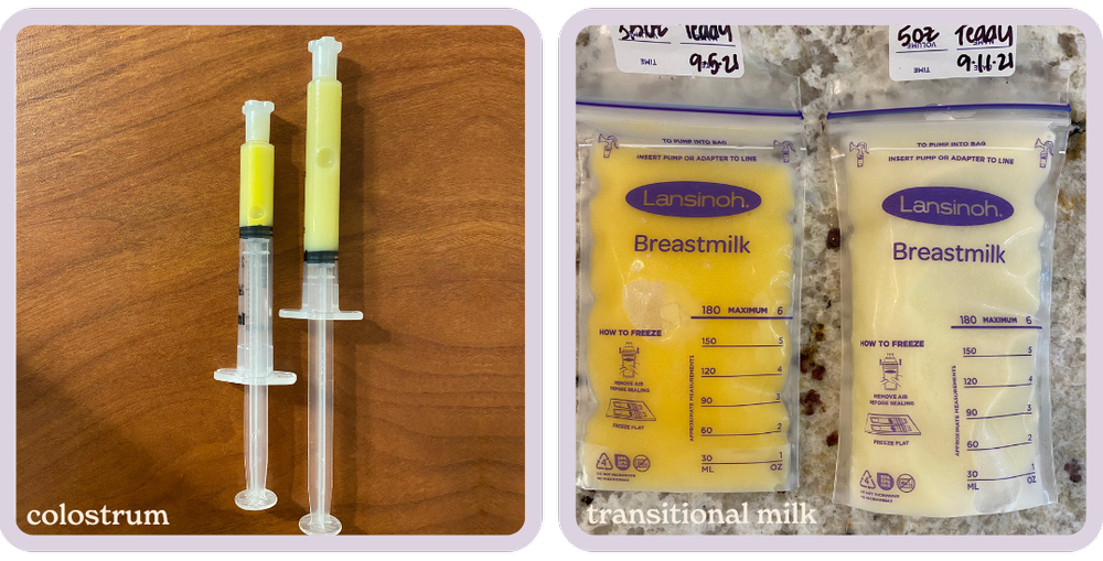 All About Colostrum | Karing for Postpartum