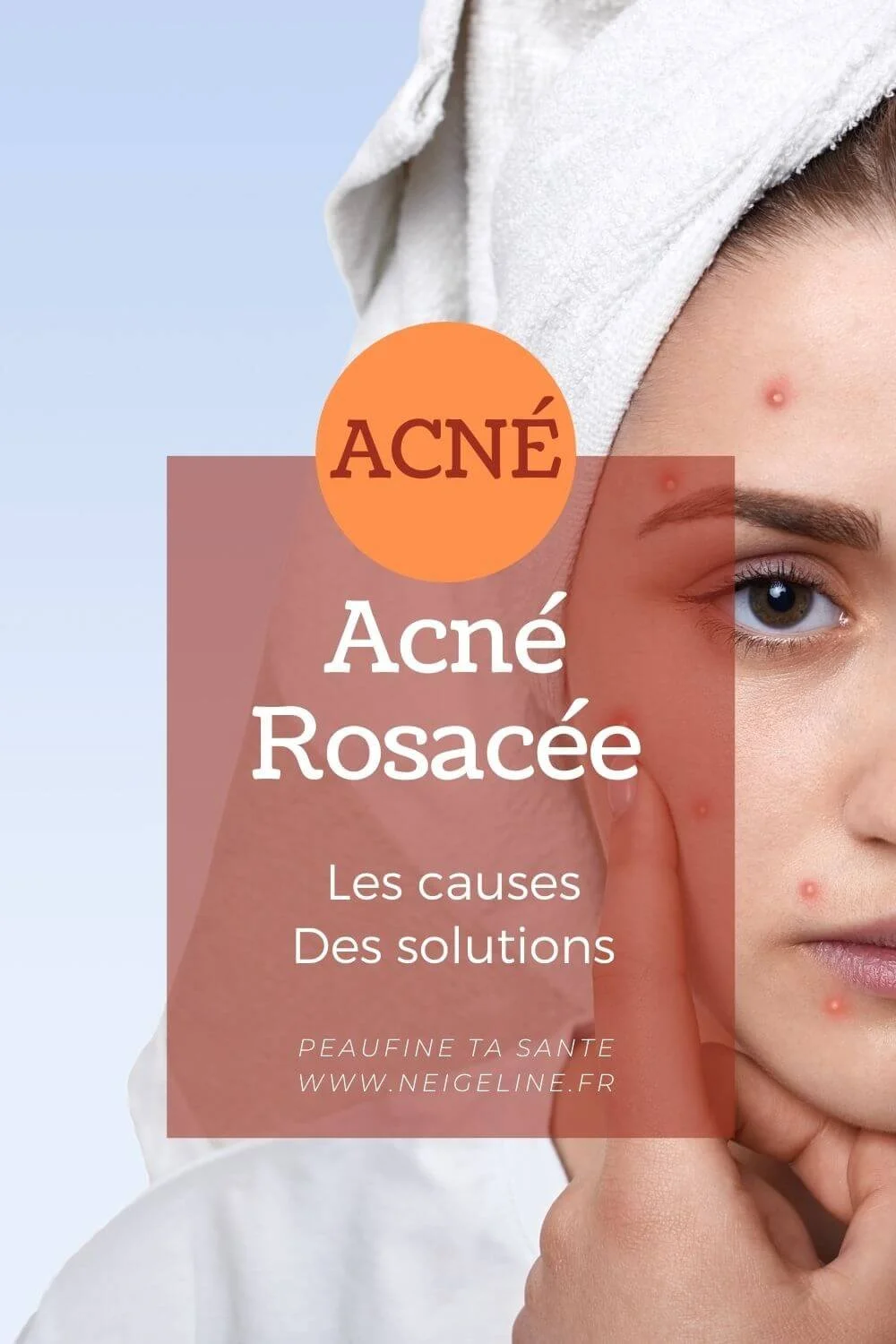 Acné rosacée : 5 façons de s’en débarrasser. — Massages particulier ...