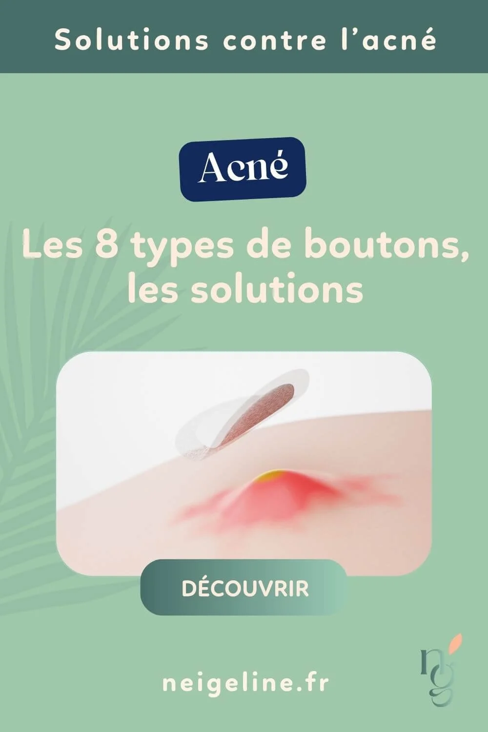 Acné : il n’y a pas 1 type de bouton, mais 8 ! — Massages particulier ...