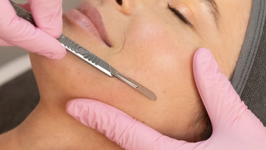DERMAPLANING | Jamele Skincare