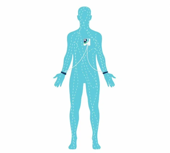 Healy Device: A Class 2a Medical Device in Europe and Its Global ...