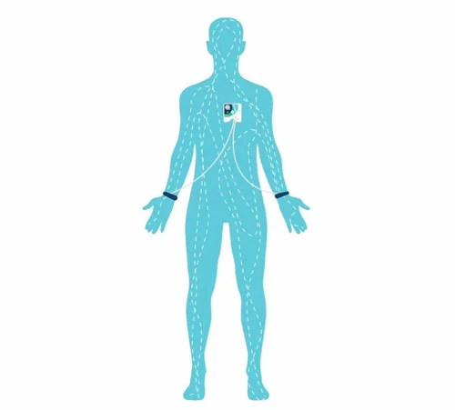 Healy Device: A Class 2a Medical Device in Europe and Its Global ...